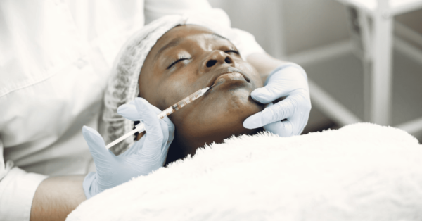 12 Surprising Benefits of Dermal Fillers - First Impressions