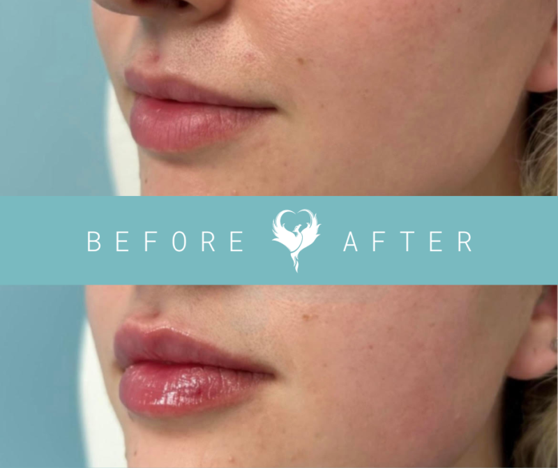 Results - First Impressions